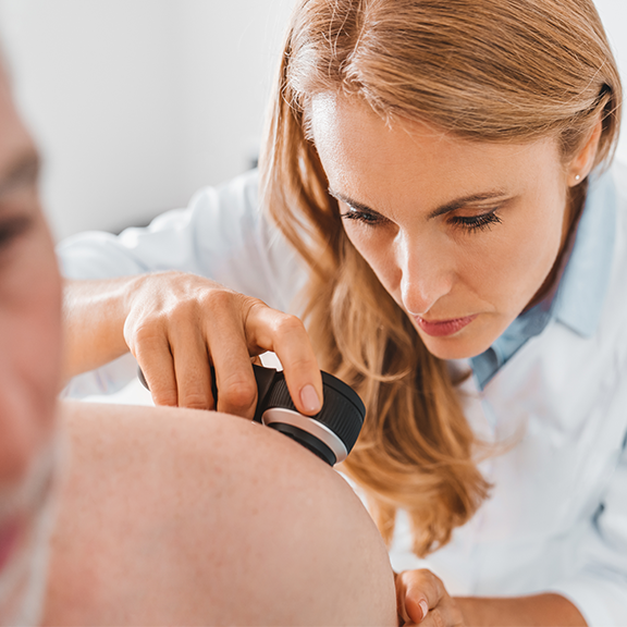 The Rising Prevalence of Skin Cancer in Canada - Think Research Canada